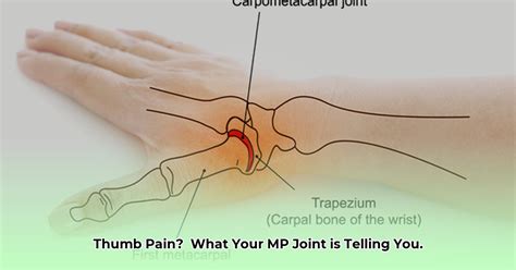 Understanding Your Thumb Mp Joint Anatomy Function And Common