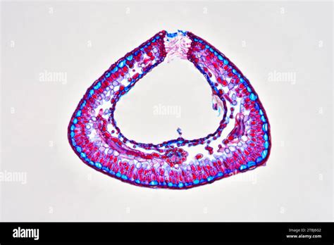 Rolled Leaf Of Calluna Vulgaris Showing Sunken Stomata Optical