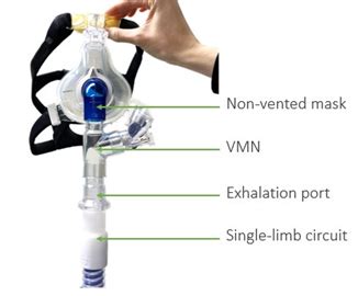 Asthma Chbc