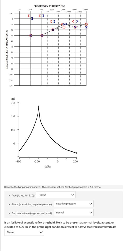 Solved Describe The Tympanogram Above The Ear Canal Volume