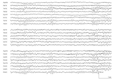 Gallery The Eeg Game