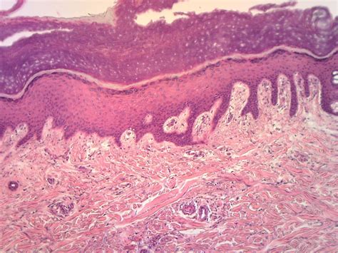 Stratified Squamous Epithelium Keratinized Skin