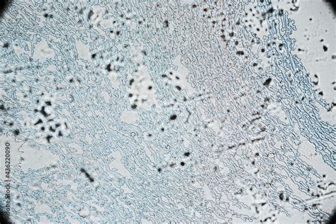 Dried Human Ejaculate Texture With Salt Crystals Under A Light Microscope Magnification 40