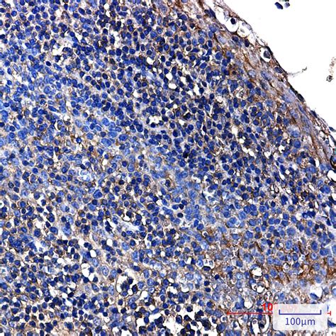 Aldoa Rabbit Mab Wb Ihc P Ihc F Icc Buy Now