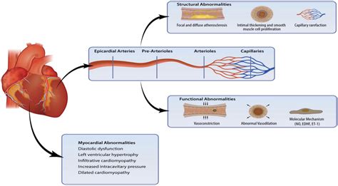 Frontiers Coronary Microvascular Dysfunction A Review Of Recent