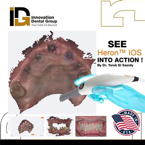 Mohamed Sonbol On Linkedin 3disc Scanner Dentistry