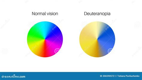 Deuteranomaly And Deuteranopia Stock Vector Illustration Of