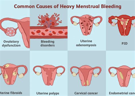 Obgyn Pathophys Key Points Flashcards Quizlet