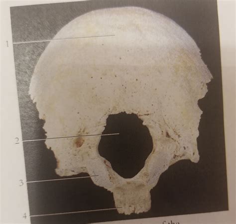 Inferior Occipital Bone Diagram Quizlet