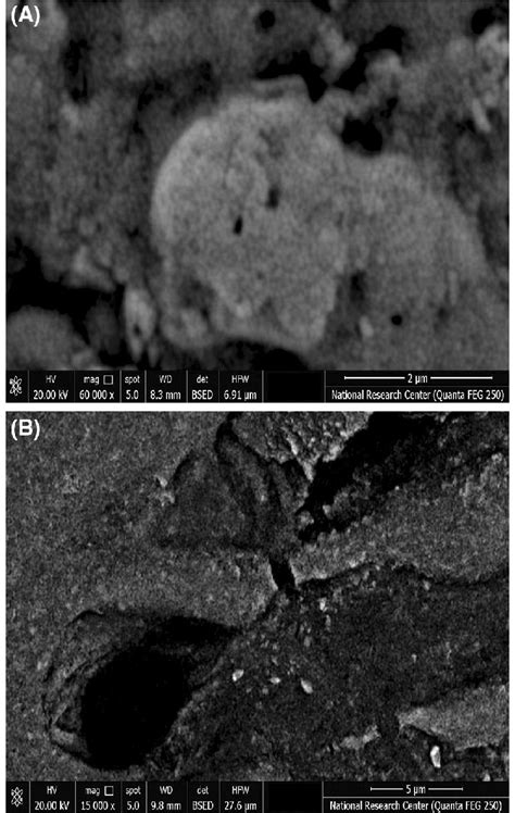 Surface Morphology Of A Nanocomposite Az91 Before Bone Formation And