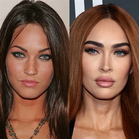 9 Celebrities Before And After Dramatic Lip Fillers Evie Magazine