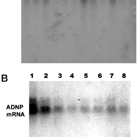 The Adnp Gene Is Conserved Among Species Comparative Studies