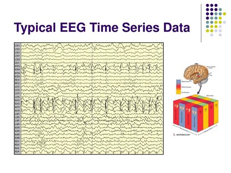 Ppt Optimization And Data Mining In Epilepsy Research Powerpoint