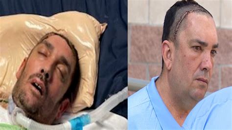 Attorney Claims Jailers Beat Harris County Inmate Into A Coma