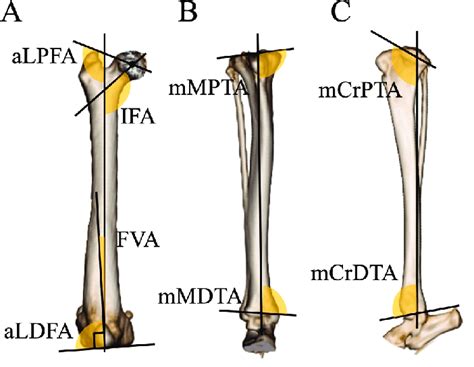 Femur And Tibia