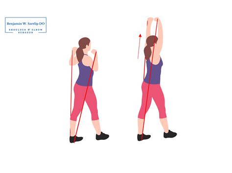 Biceps Tenodesis Protocol Austin Texas Dr Benjamin Szerlip