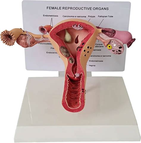 Uterus Model Labeled نتيجة الصورة لـ Uterus And Ovary