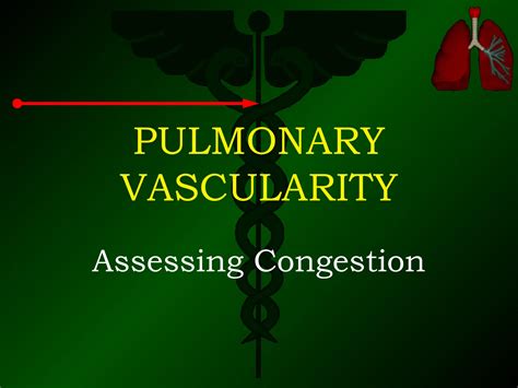 Pulmonary Circulation In Radiographyppt