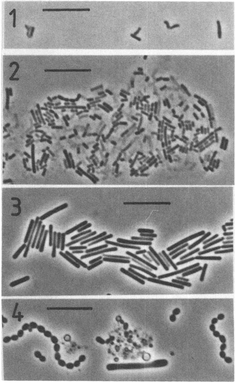 Streptococcus Lactis Microscopic