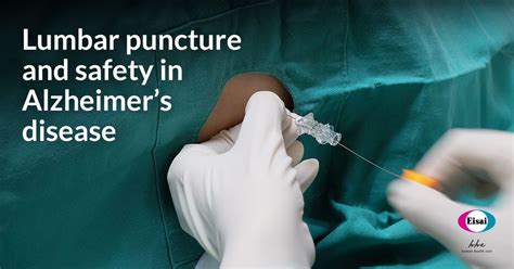 Eisai Us Neurology On Linkedin Learn About Lumbar Puncture In The