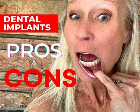 Patient Shares Pros And Cons Of Dental Implants In This Honest Review
