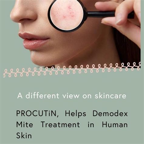 What Are Demodex Mites And Why Do They Matter Artofit
