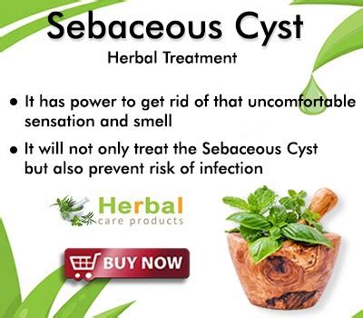 Natural Home Remedies To Treat Sebaceous Cyst