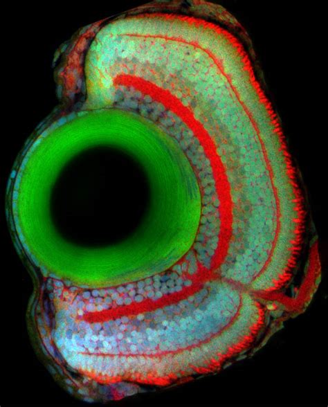 Retina — Zebrafish Ucl