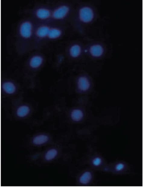 Dapi A Fluorescent Dye Can Penetrate The Cell Membrane And Bind To Download Scientific