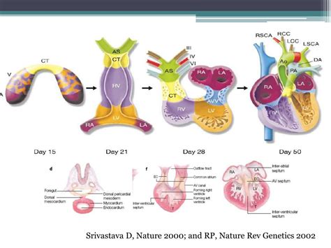 Ppt Lv Noncompaction Powerpoint Presentation Free Download Id1948729