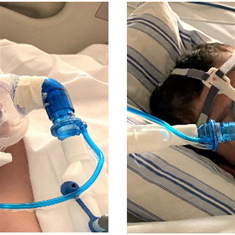 Performance Of Niv Interfaces Download Scientific Diagram