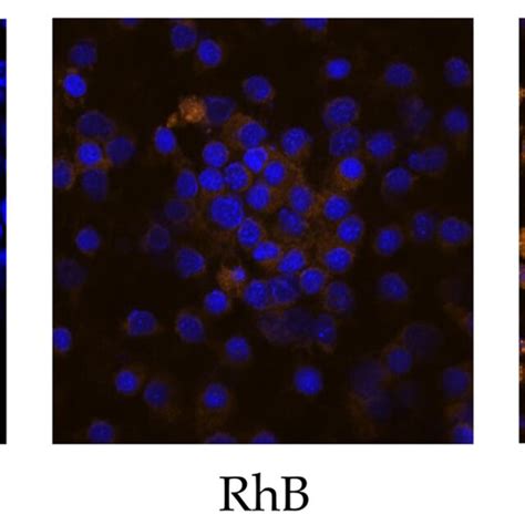 Confocal Microscope Imaging Of Mouse Bone Marrow Derived Macrophages