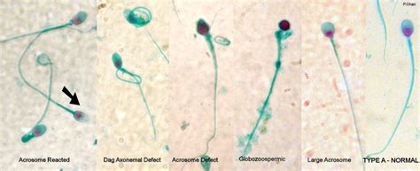 Andrology Lab Loma Linda University Fertility Center