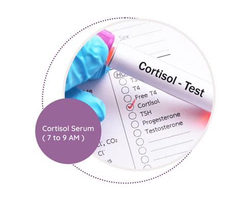 Cortisol Serum Mediscan Lab