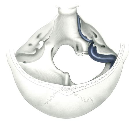 Foramen Magnum Approach Skull Base Surgery Atlas