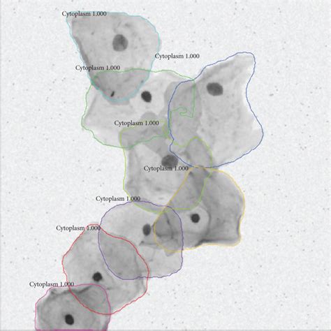 example of segmentation of a cytology image a the original