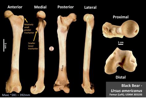 Bones Osteoid Bone Identification