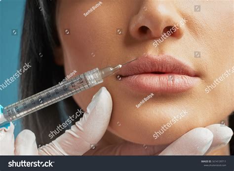 Botox Injections Lips