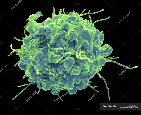 Coloured Scanning Electron Micrograph Of 293t Cell In Early Stage Of