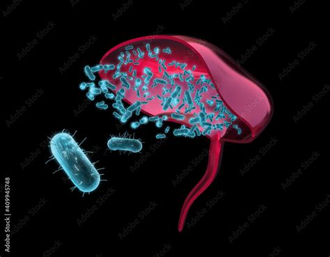 Cross Section Of The Human Bladder Cystitis An Urinary Tract