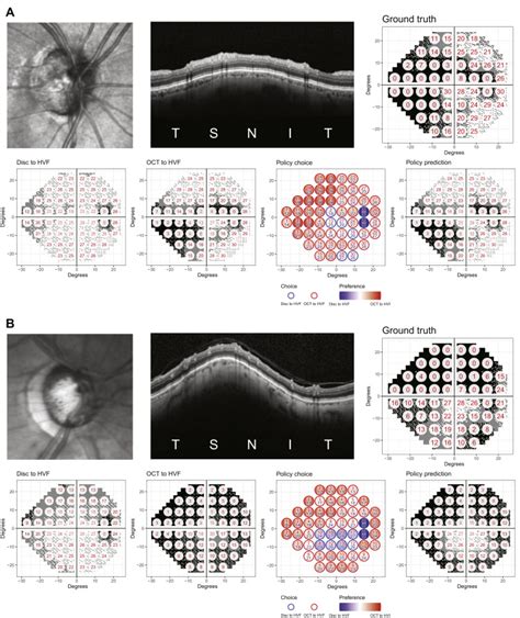 Policy Driven Multimodal Deep Learning For Predicting Visual Fields