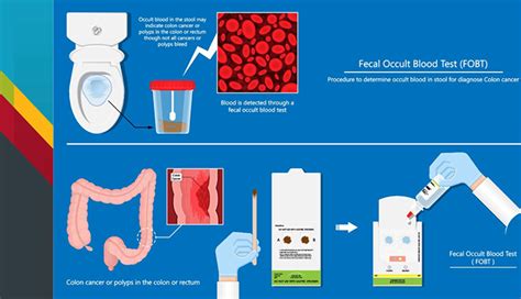 Colon Cancer Screening