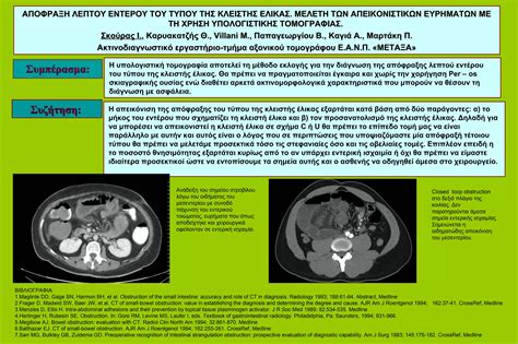 Closed Loop Obstruction