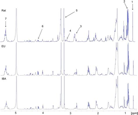 Representative 1 H Nmr Spectra Of Plasma Lipid Extract Samples Spectra Download Scientific