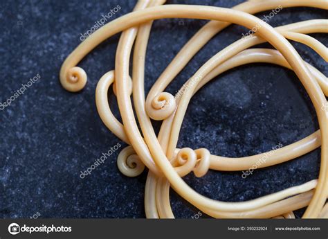 Ascariasis Lumbricoides