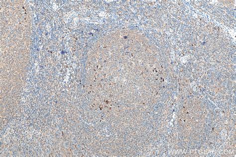 Il 1 Beta Antibody 16806 1 Ap Proteintech