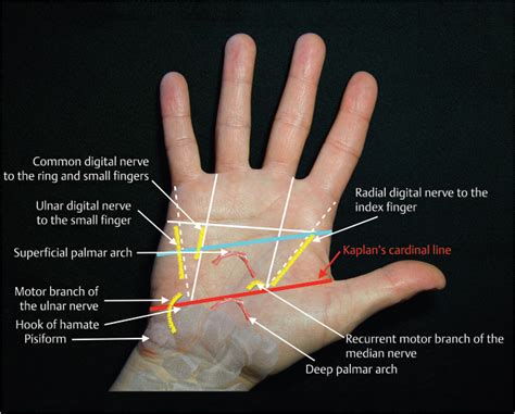 2 Structural And Functional Anatomy Of The Hand Musculoskeletal Key