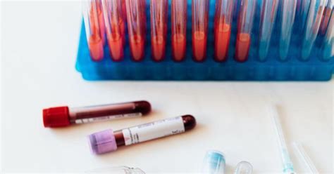 Mengenal Apa Itu Hemoglobin Dan Kadar Normalnya