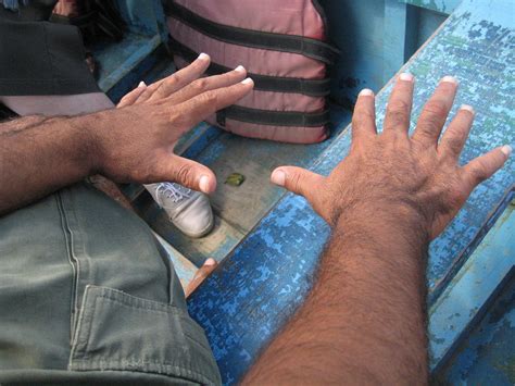 File 6 Finger  Wikimedia Commons