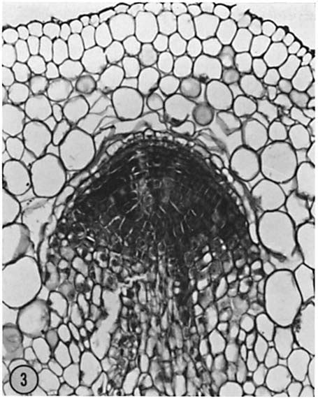 Figire 3 Root Prinlordiumn Part Way Through The Cortical Parenchyma